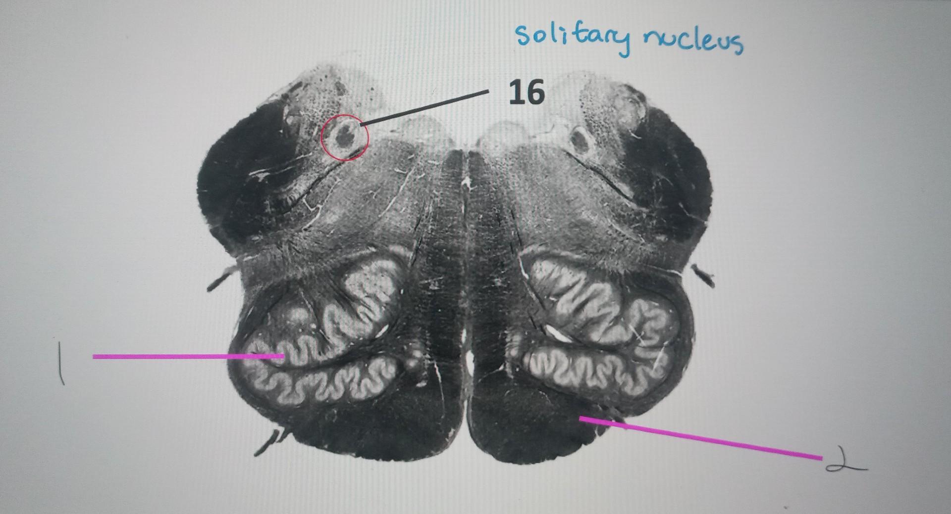 Solved Please label all the structures pointed on the black | Chegg.com