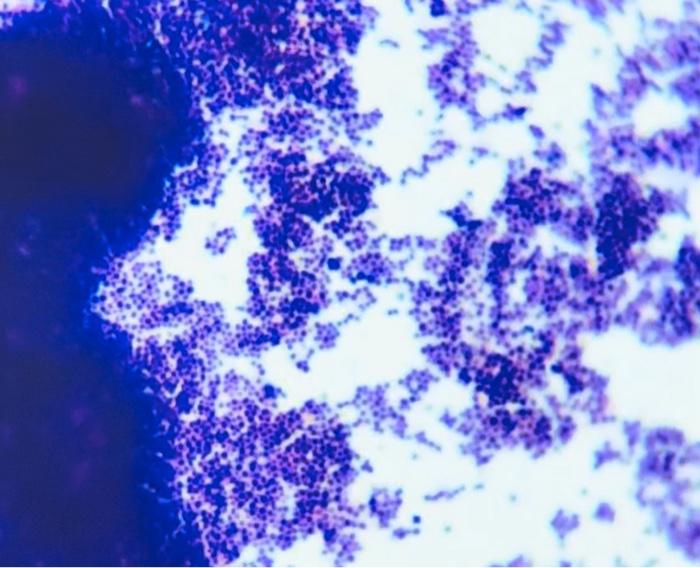 Solved What bacteria is this? It fermented in MSA plate, | Chegg.com