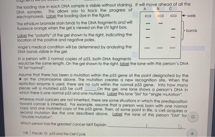 Solved - The loading dye in each DNA sample is visible | Chegg.com