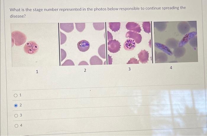 Solved What is the stage number represented in the photos | Chegg.com