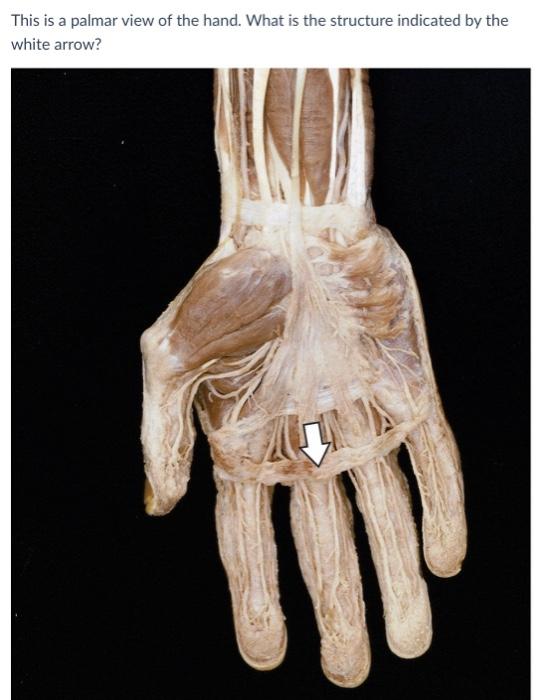 Solved This is a palmar view of the hand. What is the | Chegg.com