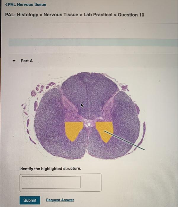 Solved Nervous Tissue > Lab Practical > Question 10 Part A | Chegg.com