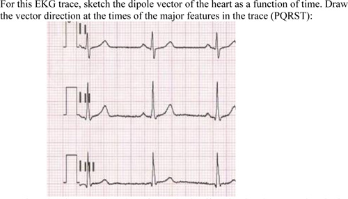 For this EKG trace, sketch the dipole vector of the | Chegg.com