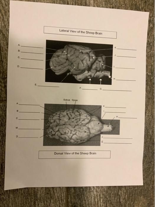 Solved Midline Anatomy Making midline cut: Once you can | Chegg.com