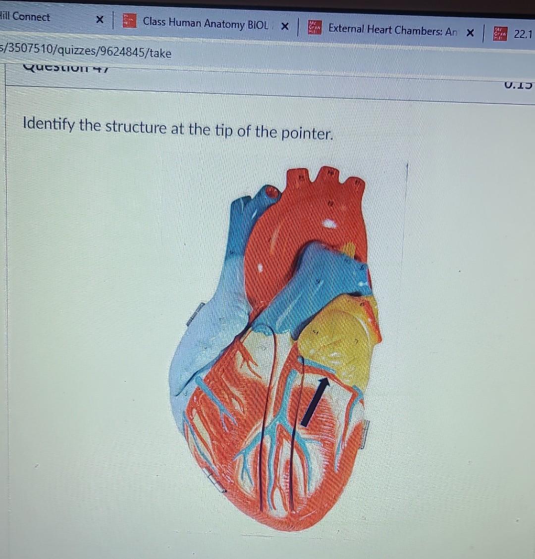 Solved Identify the structure at the tip of the | Chegg.com