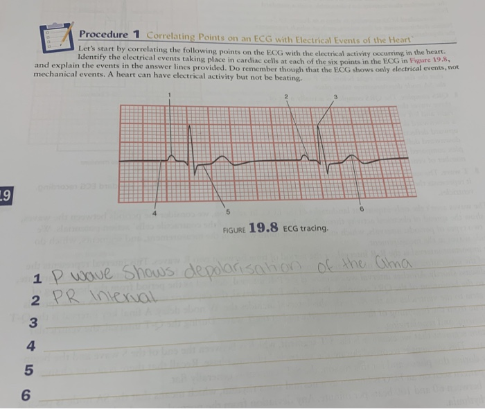 Solved Procedure 1 Correlating Points on an ECG with | Chegg.com