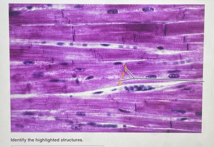 Solved Identify the highlighted structures. | Chegg.com Solved Identify the highlighted structures. | Chegg.com
