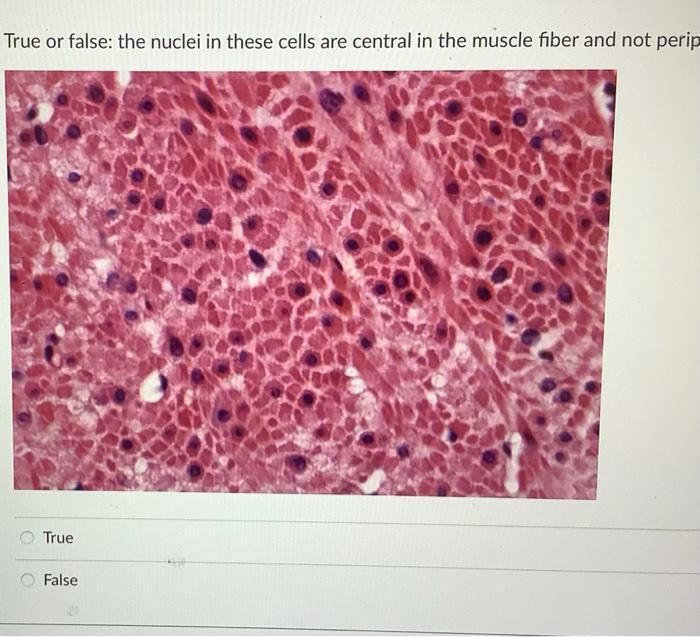 Solved True or false: the nuclei in these cells are central | Chegg.com