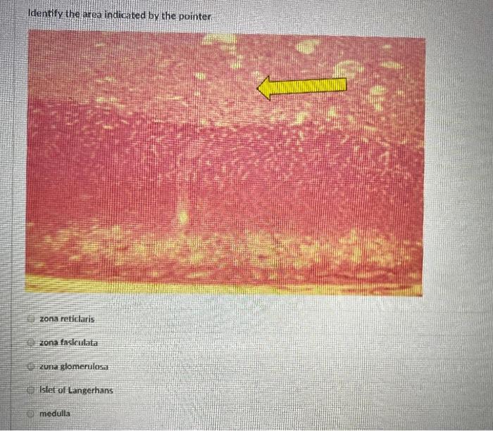 Solved Identify the area indicated by the pointer zona | Chegg.com