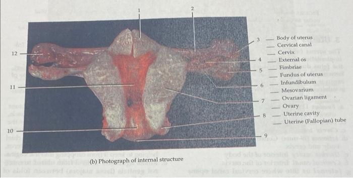 Solved 3 12 4 5 Body of uterus Cervical canal Cervix | Chegg.com