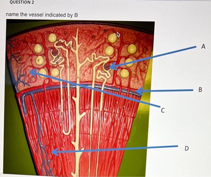 Solved QUESTION 2 name the vessel indicated by B | Chegg.com