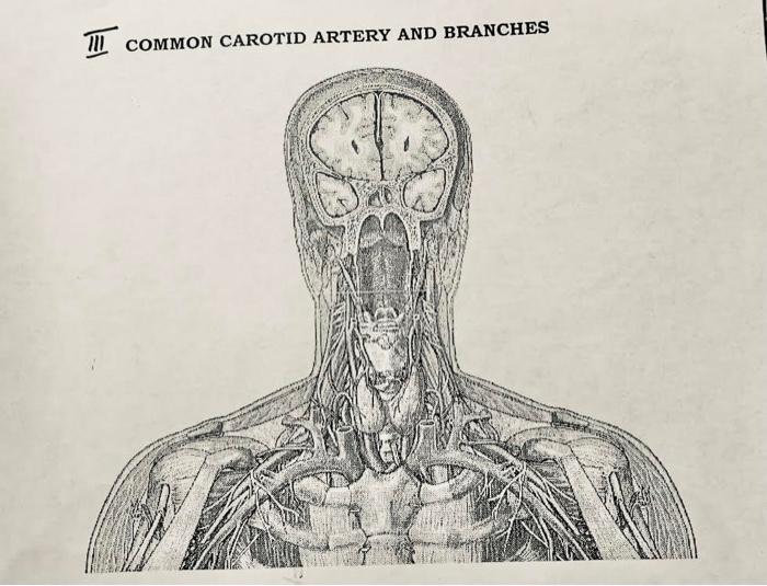 Solved MI COMMON CAROTID ARTERY AND BRANCHES | Chegg.com