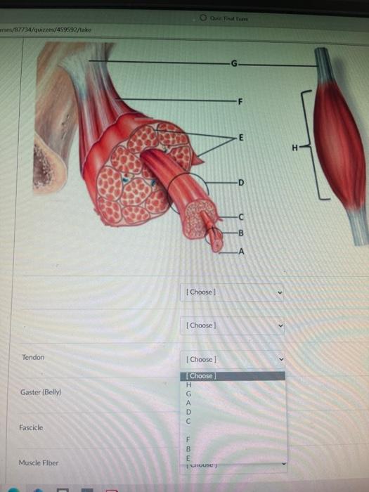 Solved Tendon Gaster (Belly) Fascicle Muscle Flber | Chegg.com