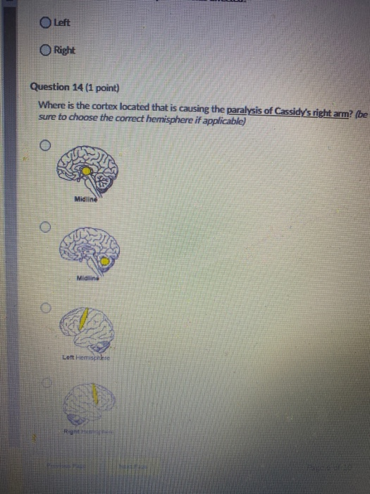 Solved Mikey has a tumor growing in his brain. The tumor has | Chegg.com