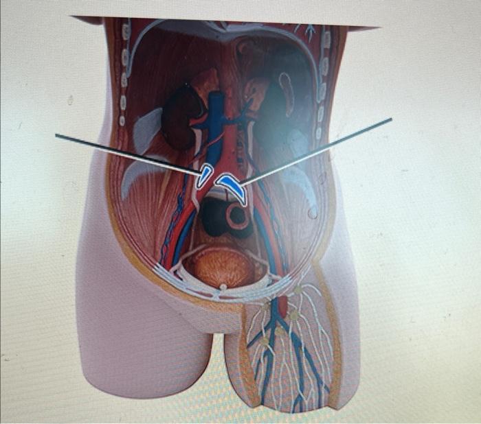 Solved ZD O O O O Thoracic aorta Common carotid artery Arch | Chegg.com