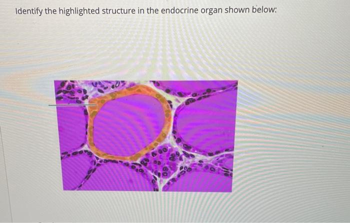 Solved Identify the highlighted structure in the endocrine | Chegg.com