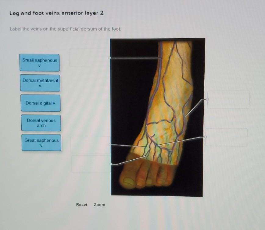 Solved Shoulder and arm arteries part 2 Label the blood | Chegg.com