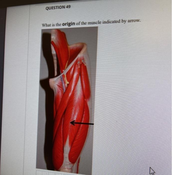 Solved QUESTION 49 What is the origin of the muscle | Chegg.com