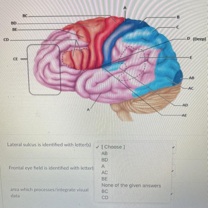 Solved Lateral sulcus is identified with letter(s) Frontal | Chegg.com