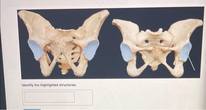 Solved Identify the highlighted structures. | Chegg.com Solved Identify the highlighted structures. | Chegg.com