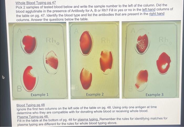 Whole Blood Typing pg 47 Pick 2 samples of tested | Chegg.com