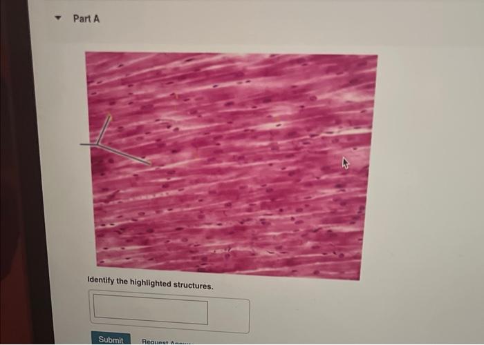 Solved Idenury the highlighted fiber type. Identify the | Chegg.com