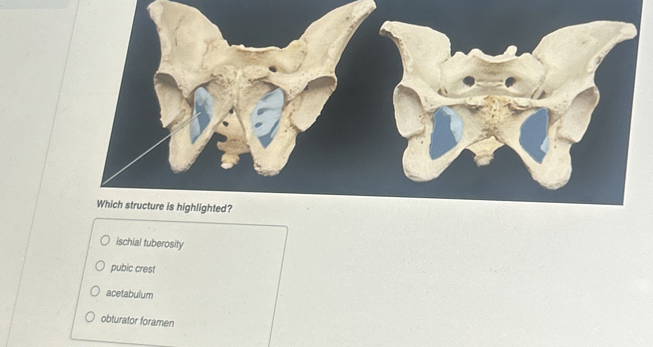 Solved Which structure is highlighted?ischial | Chegg.com