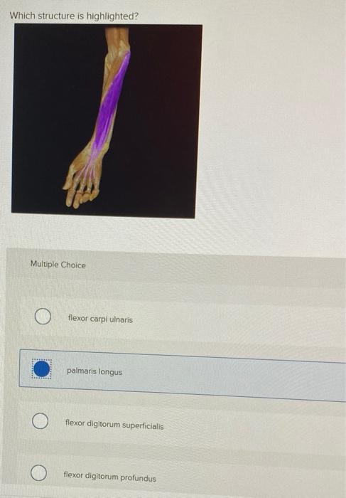 Solved Which structure is highlighted? Multiple Choice | Chegg.com