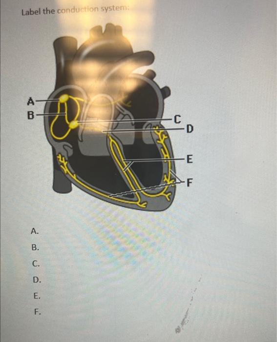 Solved Label the conduction system: | Chegg.com