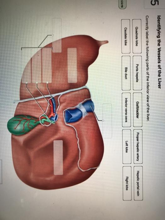 Solved Identifying the Vessels of the Liver 5 Correctly | Chegg.com