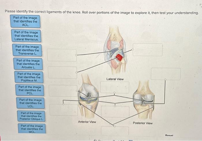 Solved Please identify the correct ligaments of the knee. | Chegg.com