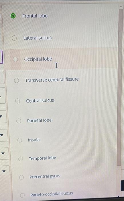 Frontal lobe Lateral sulcus Occipital lobe | Chegg.com
