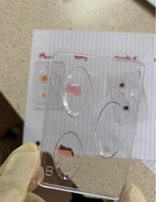 Solved due in an hour please help me use the blood sample si | Chegg.com