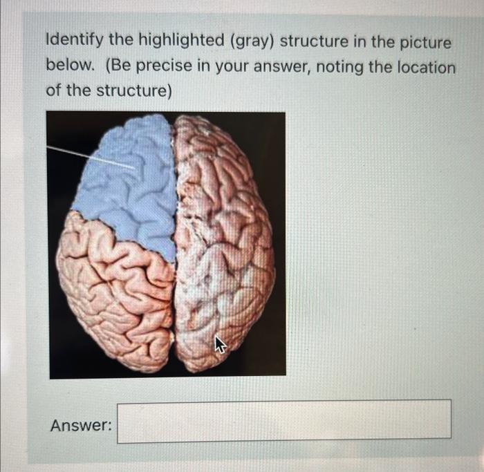 Solved Identify the structure highlighted green in the | Chegg.com