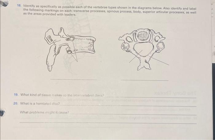 Solved 18. Identify as specifically as possible each of the | Chegg.com