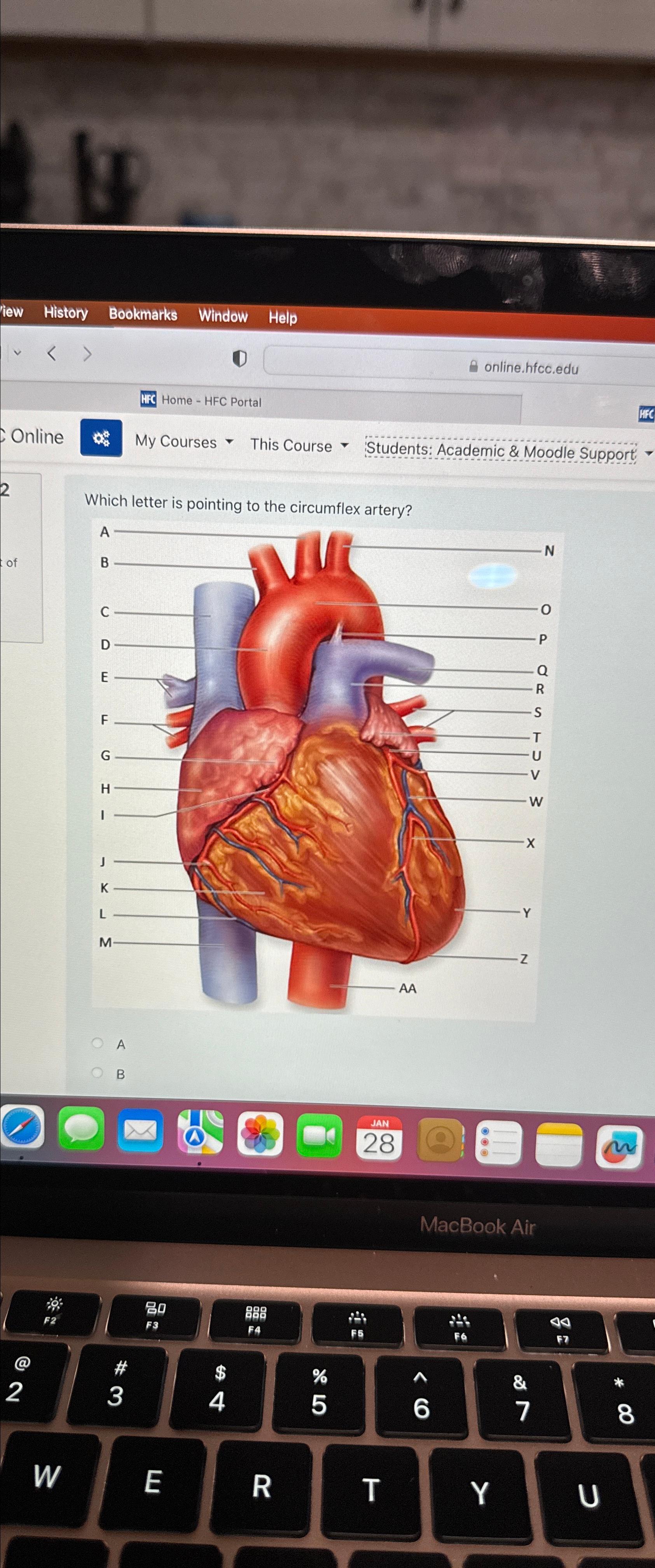 Solved Which letter is pointing to the circumflex artery?AB | Chegg.com