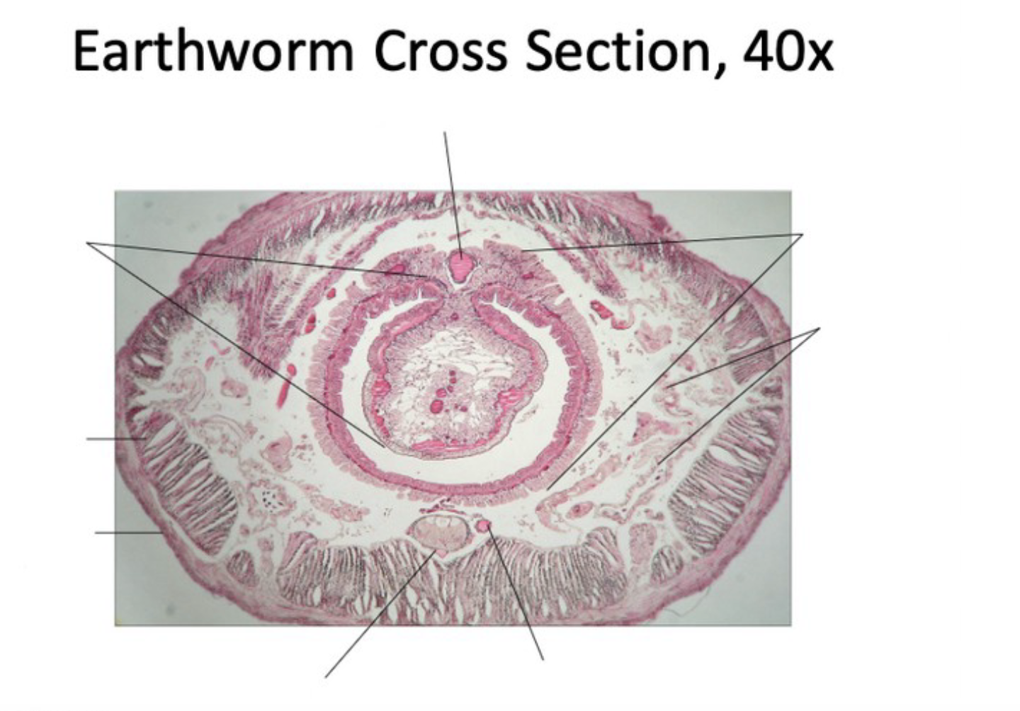 Solved Fill in the blank Earthworm Cross Section, 40x | Chegg.com