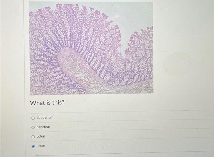 Solved What is this? duodenum pancreas colon ileum | Chegg.com