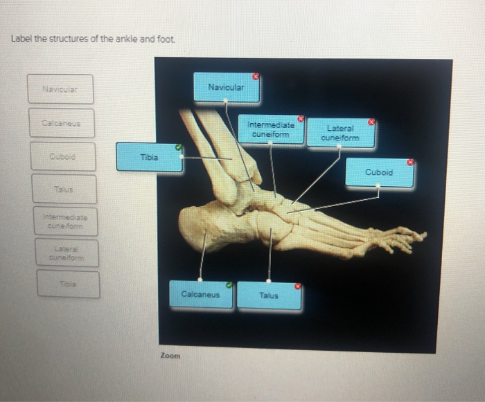 Solved Label the structures of the ankle and foot. Navicular | Chegg.com