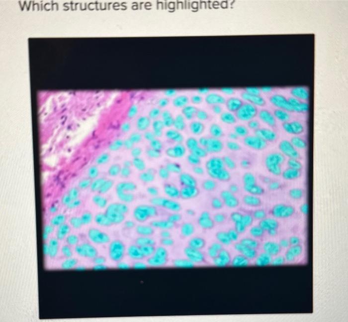 Multiple Choice lamella with osteocytes lacuna with | Chegg.com