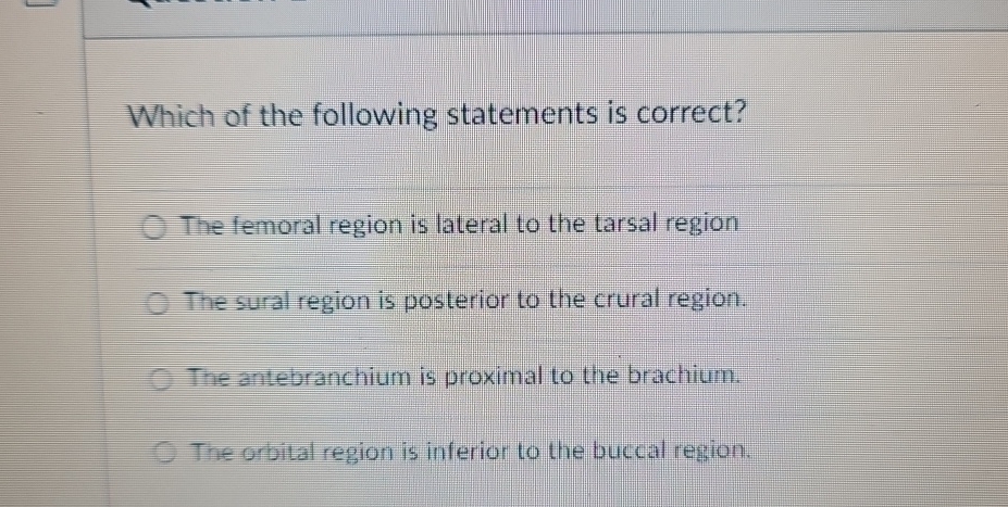 Solved Which of the following statements is correct?The | Chegg.com