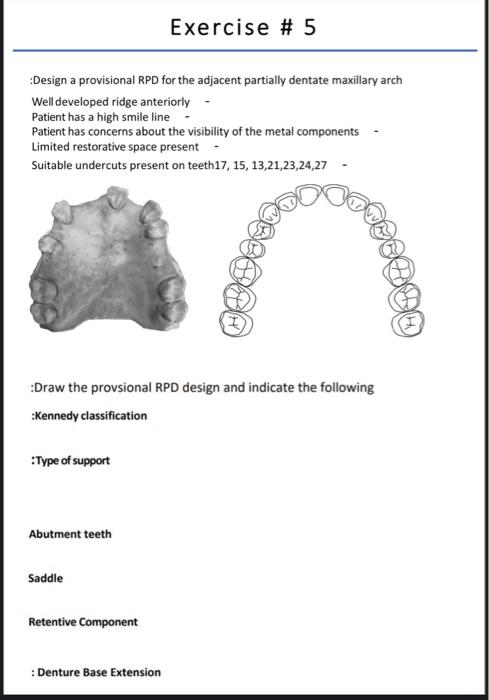 Solved Exercise # 5 Design a provisional RPD for the | Chegg.com