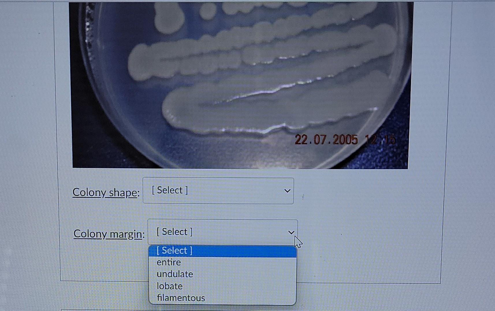Solved CO October 22.07.2005 Colony shape: [Select ] [ | Chegg.com