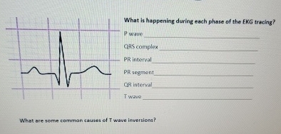 Solved What is happening during each phase of the EKG | Chegg.com
