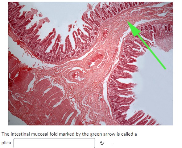 Solved The intestinal mucosal fold marked by the green | Chegg.com