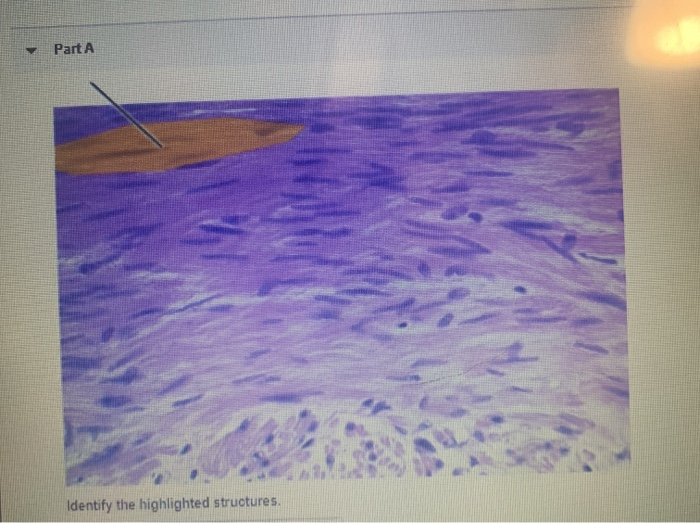 Solved Part A Identify the highlighted structures, | Chegg.com