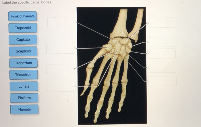 Solved Label the specific carpal bones. Hook of hamate | Chegg.com