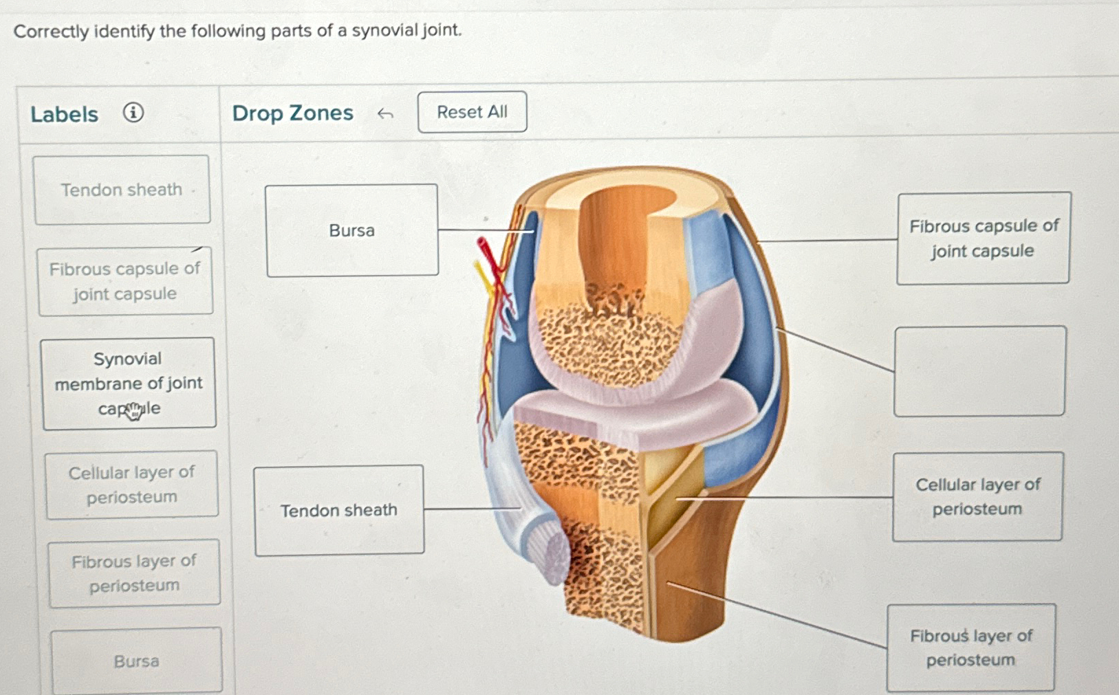 Solved Correctly identify the following parts of a synovial | Chegg.com