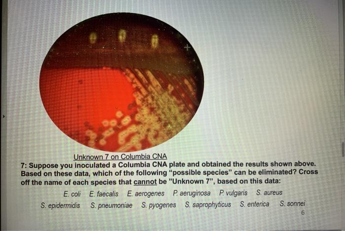 Solved Unknown 7 on Columbia CNA 7: Suppose you inoculated a | Chegg.com