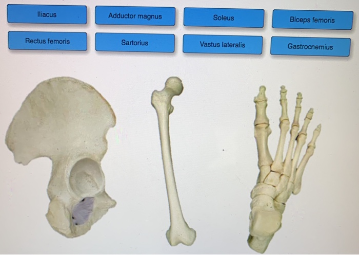 Solved Place the following muscle in the appropriate | Chegg.com Solved Place the following muscle in the appropriate | Chegg.com